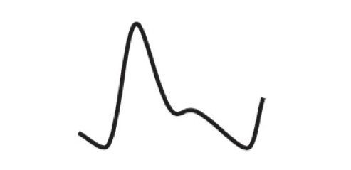 Pulse Wave Parameters - Vascular Academy | powered by SOT