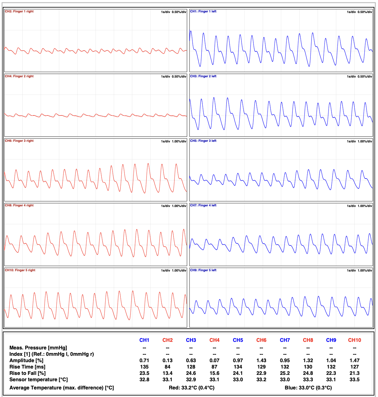 OPO – Optische Puls-Oszillographie - Vascular Academy | powered by SOT