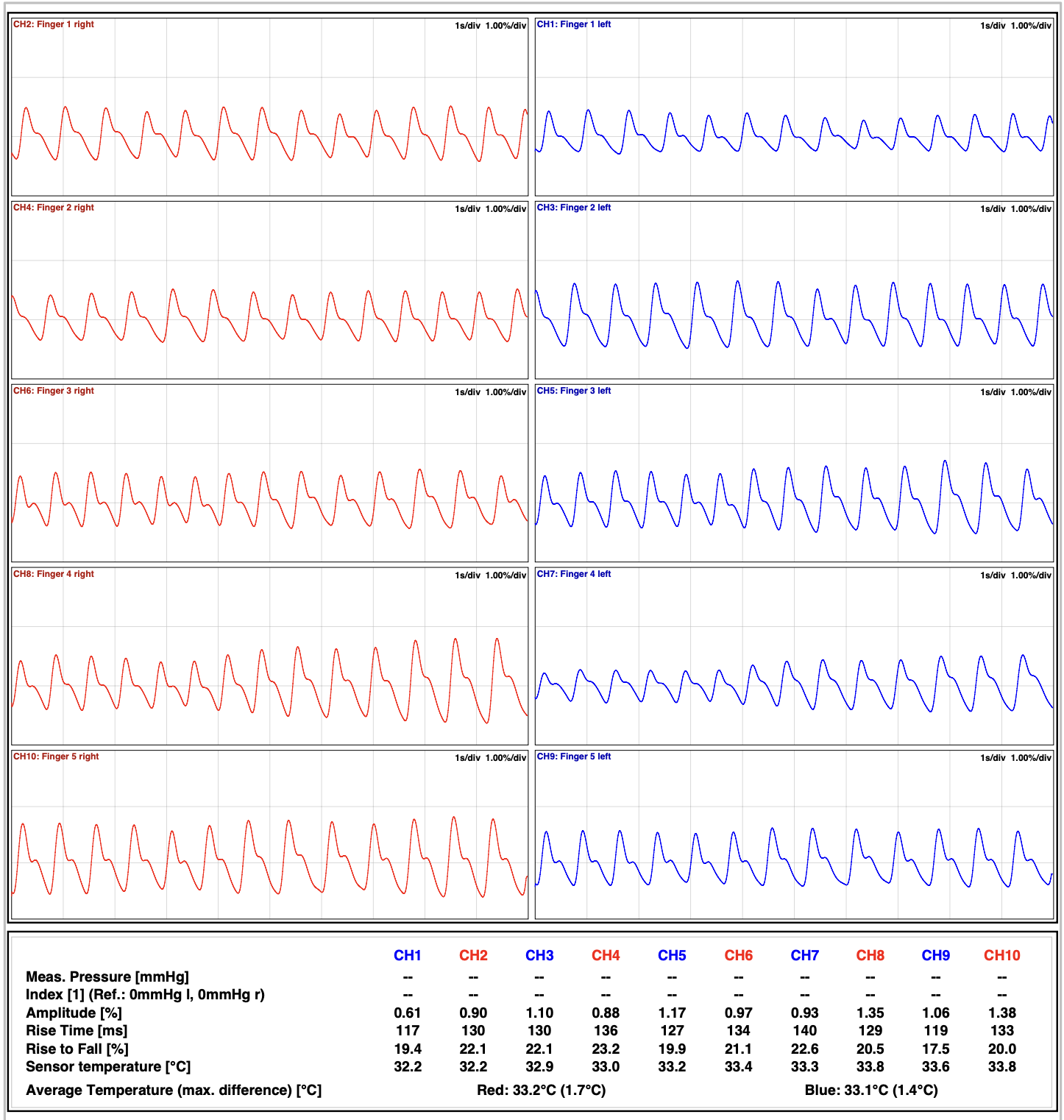 OPO – Optical Pulse Oscillography - Vascular Academy | powered by SOT
