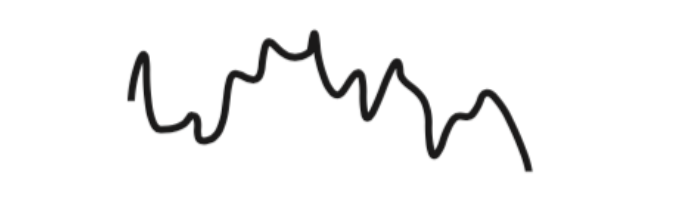 Pulse Wave Parameters - Vascular Academy | powered by SOT