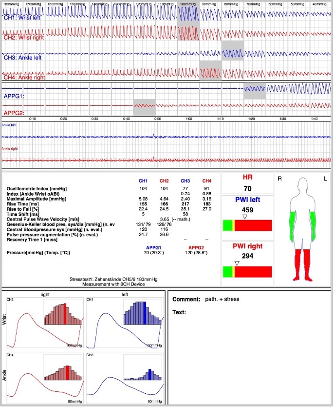 TOPP-Method (Tissue Optical Perfusion Pressure) - Vascular Academy ...