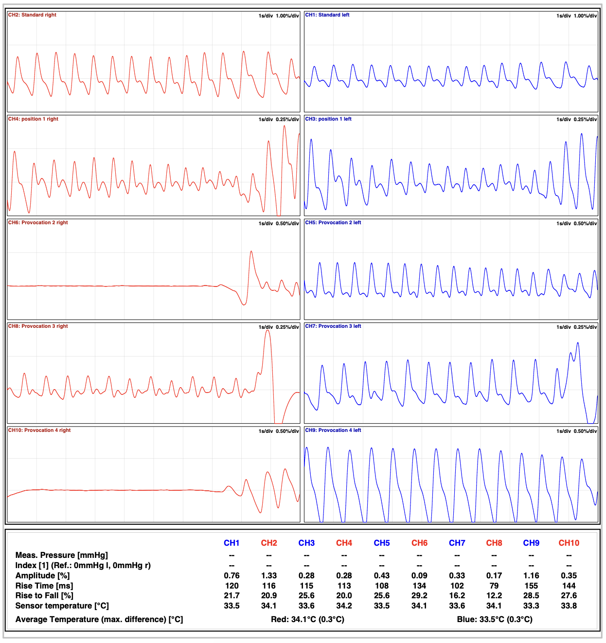 TOS-Test (Thoracic Outlet Syndrome) - Vascular Academy | powered by SOT